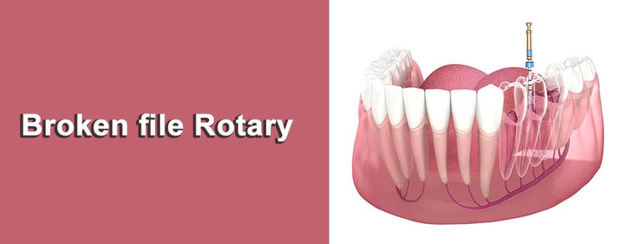 چه کنیم که فایل های روتاری نشکنند | راستین هسته سلامت